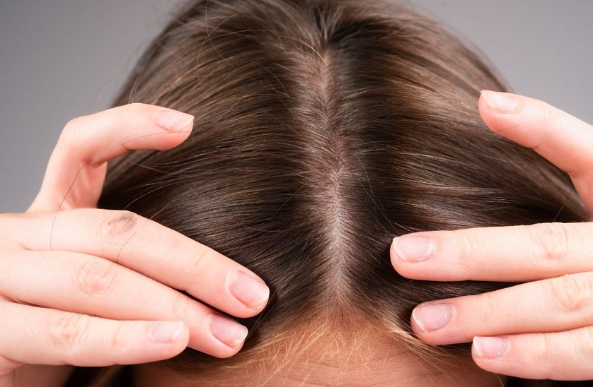 Normal Hair Parting Width vs Thinning: Causes and Treatments