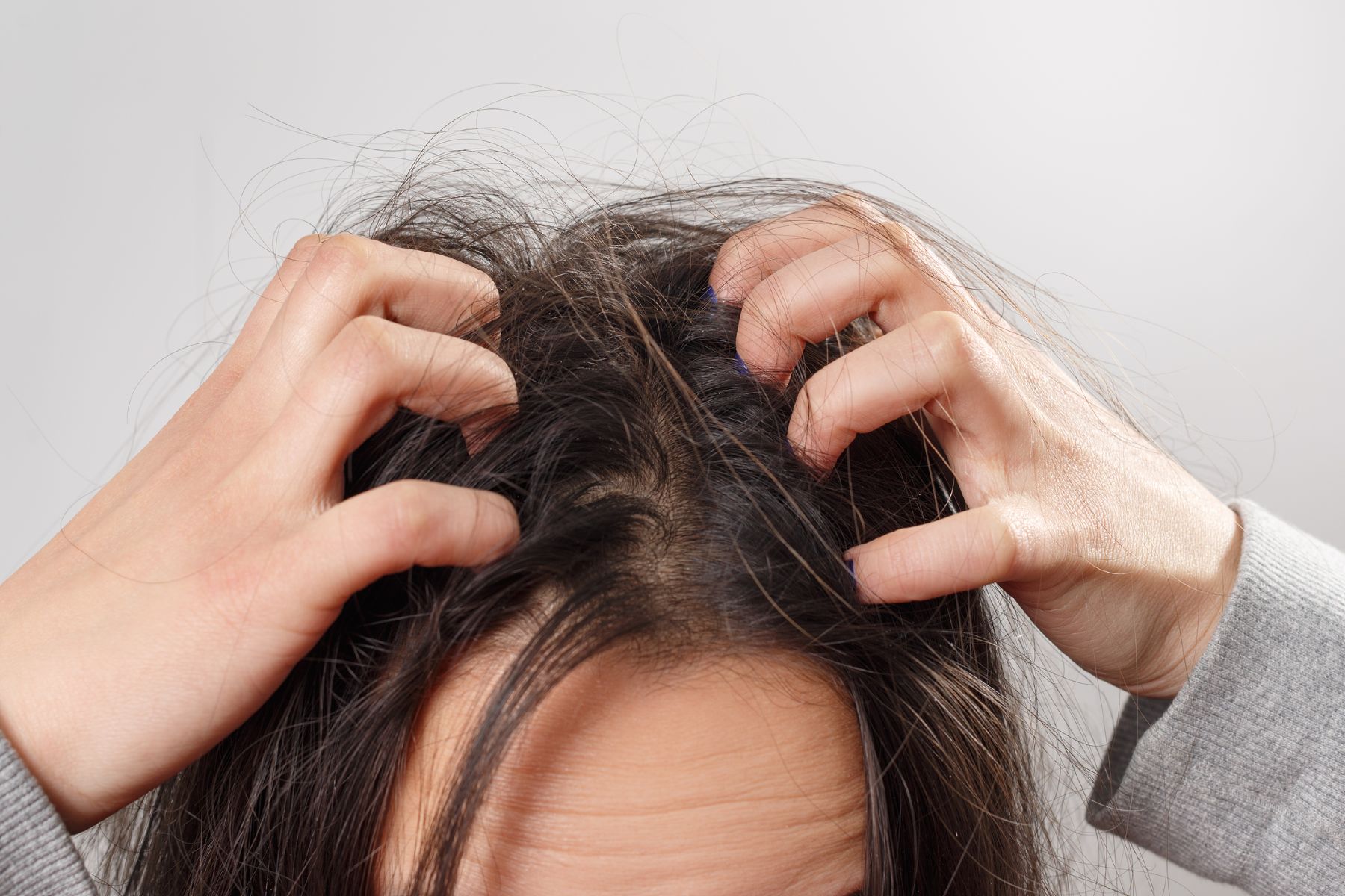 How To Deal With An Itchy Scalp From Minoxidil - Wimpole Clinic