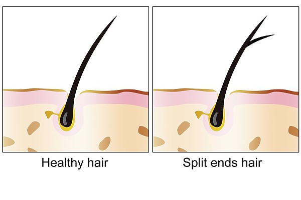Split Ends vs Healthy Hair: Expert Advice to Tell Them Apart