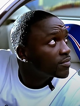 Akon Hair Transplant: Everything You Need to Know - Wimpole Clinic