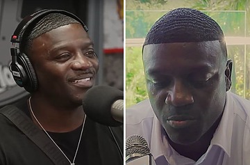 Akon Hair Transplant: Everything You Need to Know - Wimpole Clinic