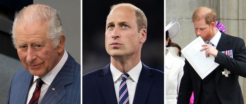 Prince Harry’s Hair Transplant - Everything You Need To Know