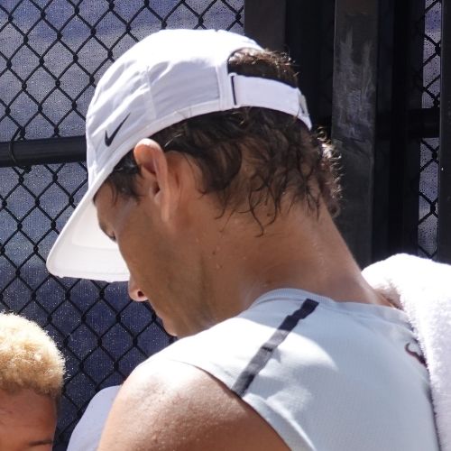 Rafael Nadal Hair Transplant: Everything You Need To Know