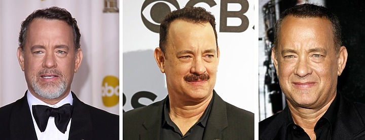 Tom Hanks’ Hair Transplant: Everything You Need to Know