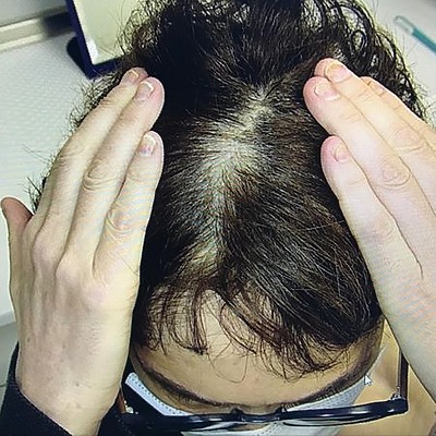 Do Selenium Supplements Benefit Your Hair?