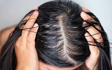 Common Reasons Why Your Hair Is Greasy (and How to Fix It)