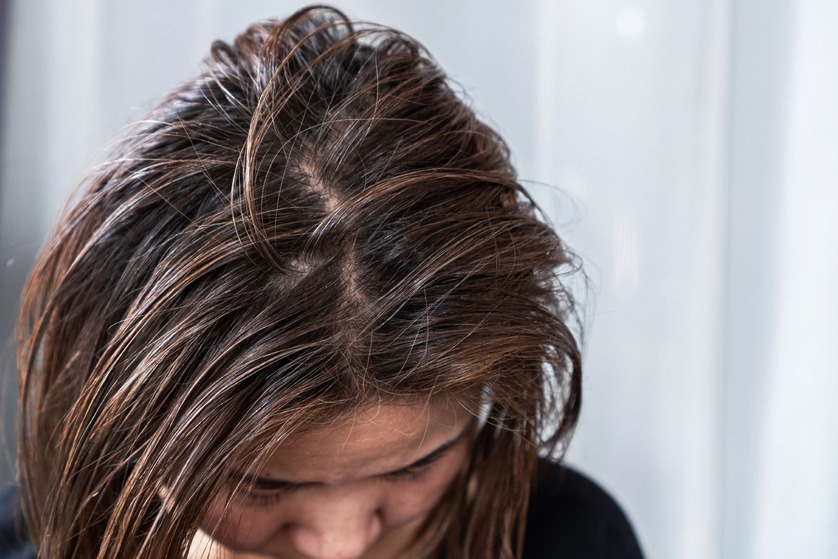 Common Reasons Why Your Hair Is Greasy (and How to Fix It)