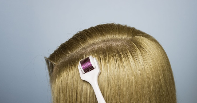 Saw Palmetto For Women’s Hair Loss: Benefits vs Risks