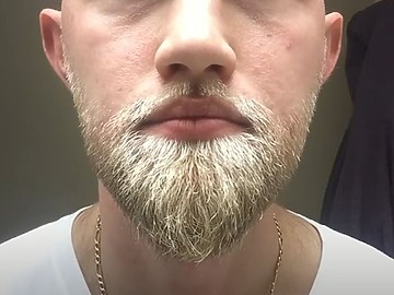 7 Bad Beards & Better Facial Hair Styles You Can Try Instead