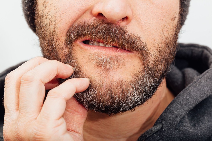 13 Proven Ways To Fix a Patchy Beard - Wimpole Clinic