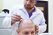 Hair Pull Test: Everything You Need To Know - Wimpole Clinic