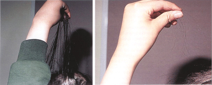 Hair Pull Test: Everything You Need To Know - Wimpole Clinic