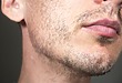 7 Common Causes Of Patchy Beard Growth
