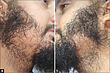 7 Common Causes Of Patchy Beard Growth