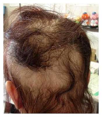Is semi-permanent hair dye damaging? - Wimpole Clinic