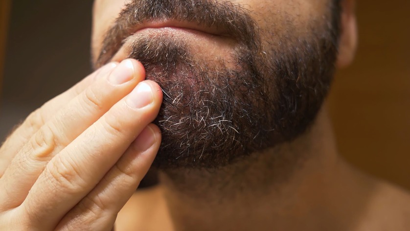 Could You Have a Beard Hair Loss Fungus? And Which One?