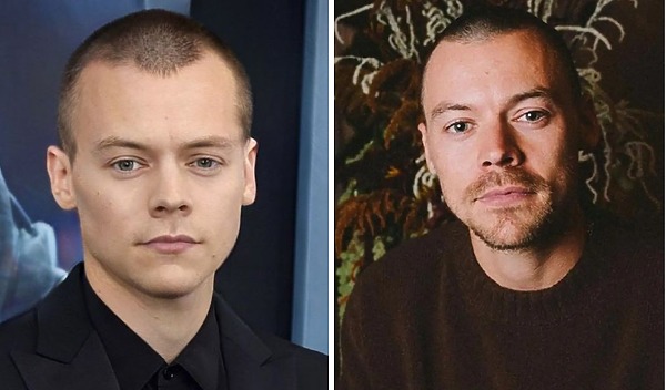 Is Harry Styles Balding? The Scoop on Harry’s Hair Journey