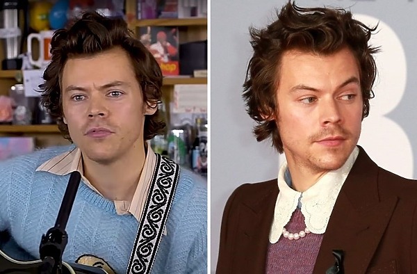 Is Harry Styles Balding? The Scoop on Harry’s Hair Journey
