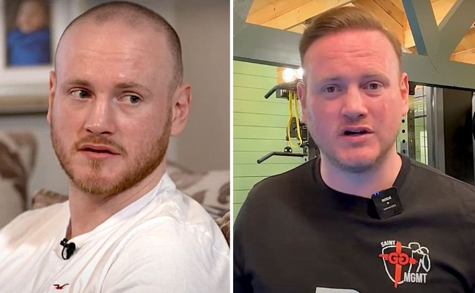 George Groves Hair Transplant: How He Transformed His Look