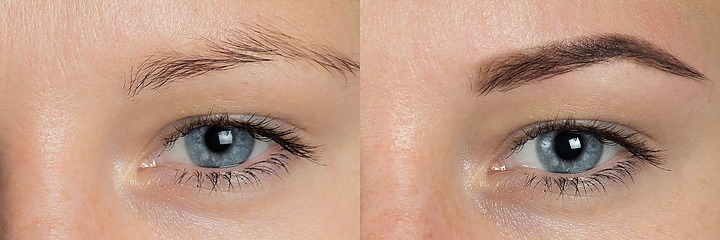 10 Ways To Fix Sparse Eyebrows - Wimpole Clinic