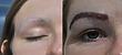 How Long Does It Take for Eyebrows to Grow Back?