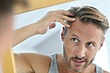 10 Ways To Deal With A Bad Receding Hairline - Wimpole Clinic
