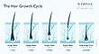 Hair Pull Test: Everything You Need To Know - Wimpole Clinic