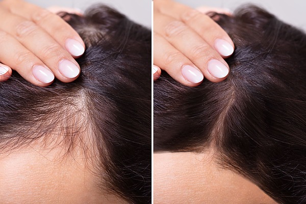 The Best Hair Density Tests to Measure Hair Fullness