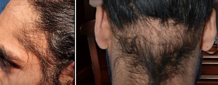 Hair Extensions For Men: A Practical Guide