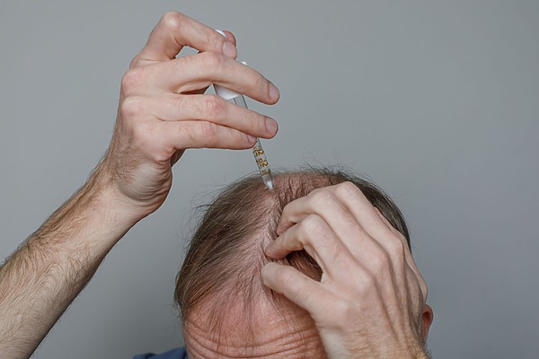 The Best Hair Density Tests to Measure Hair Fullness