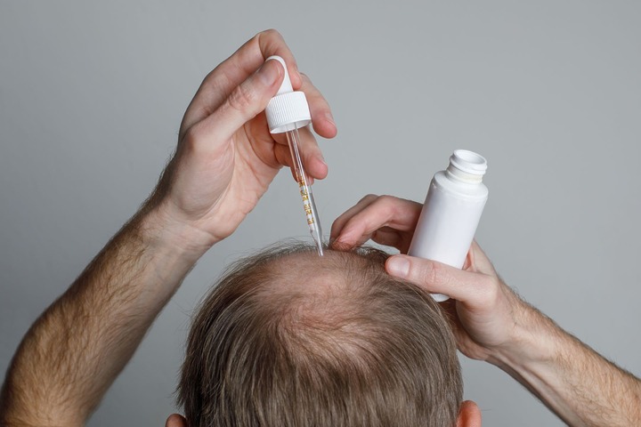 Keeps Vs Hims For Hair Loss: The Best Choice for 2025