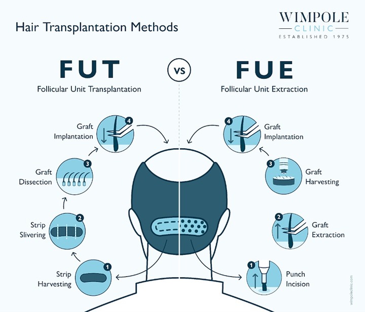 When Can I Rub My Head After a Hair Transplant? A Full Guide