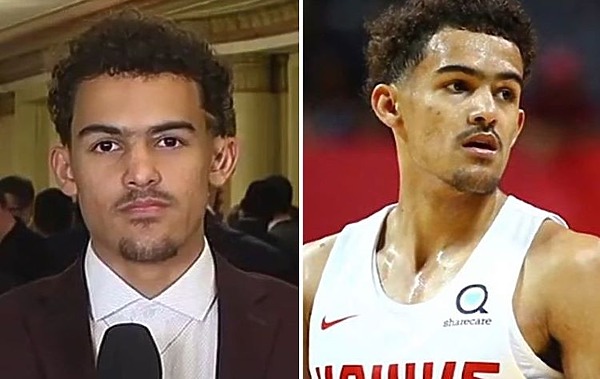 Is Trae Young Balding? How His Hair Has Changed