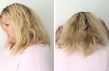 What Is Dead Hair And What Do Dead Hair Follicles Look Like?