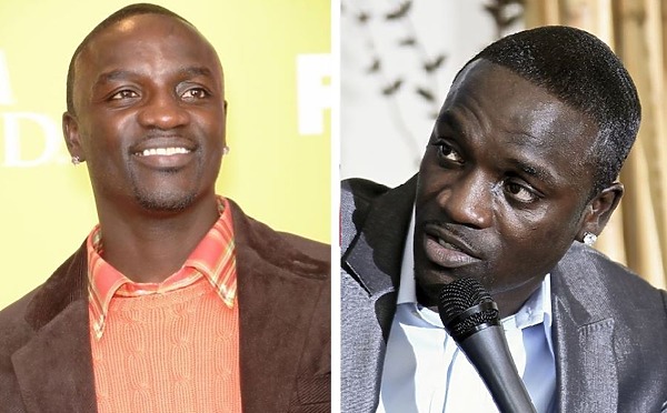 Akon Hair Transplant: Everything You Need to Know - Wimpole Clinic
