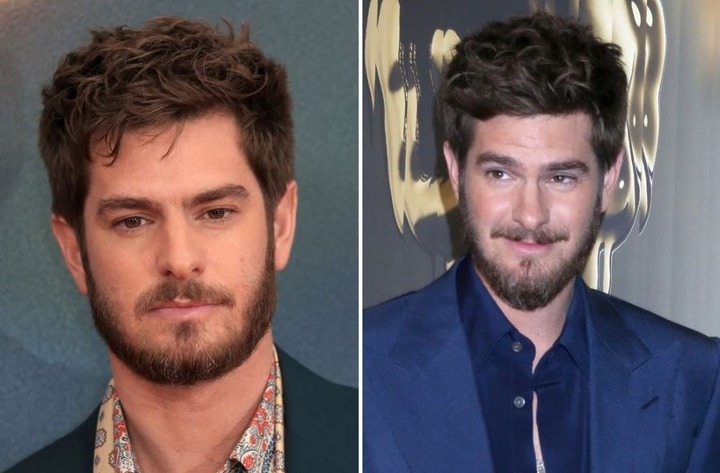 Andrew Garfield’s Hair Transplant: Rumours, Photos, Evidence