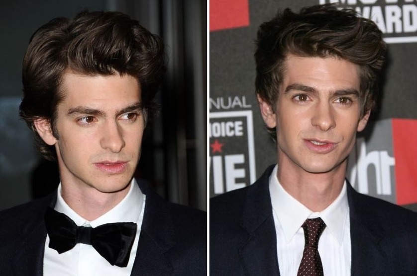 Andrew Garfield’s Hair Transplant: Rumours, Photos, Evidence