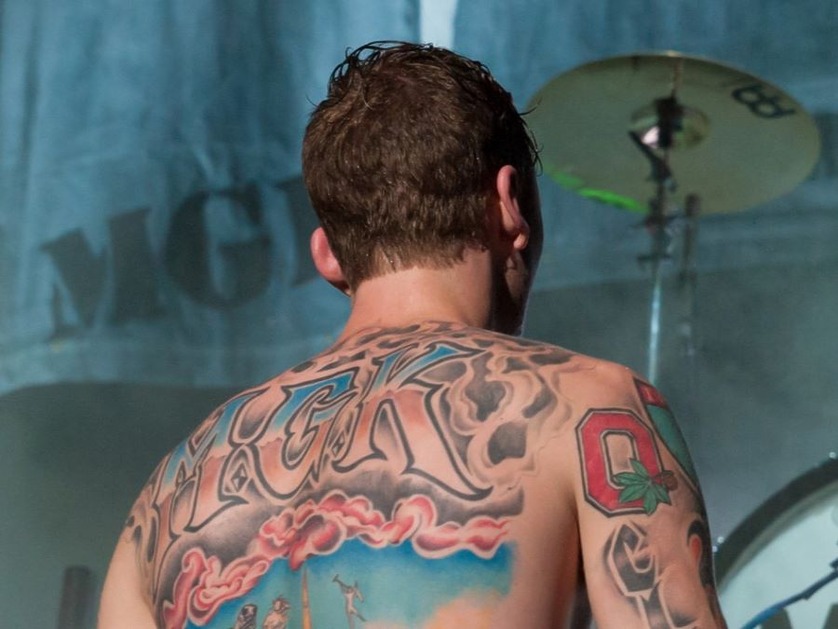 Machine Gun Kelly’s Hair Transplant: Did It Happen?