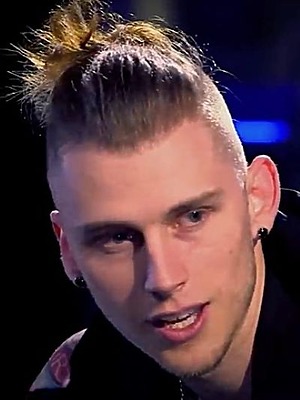 Machine Gun Kelly’s Hair Transplant: Did It Happen?
