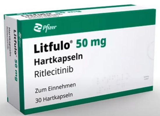 Can I Use Litfulo For Male Pattern Baldness?