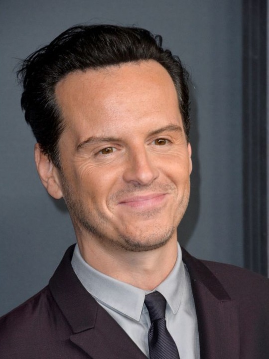 Andrew Scott’s Hair Transplant - Did It Really Happen?