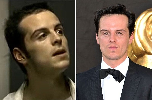 Andrew Scott’s Hair Transplant - Did It Really Happen?
