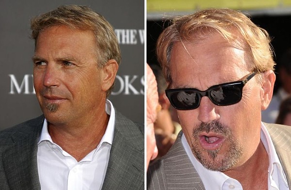 Kevin Costner’s Hair Transplant: Everything You Need to Know