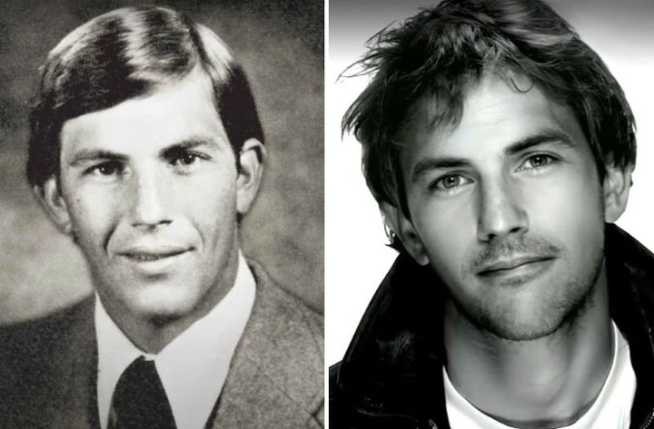 Kevin Costner’s Hair Transplant: Everything You Need to Know