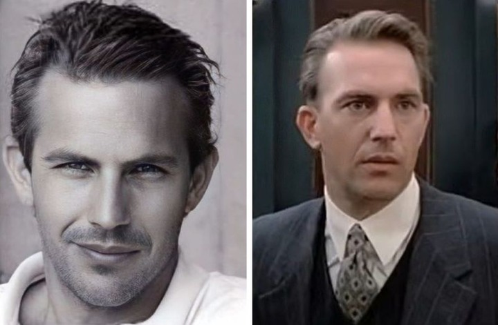 Kevin Costner’s Hair Transplant: Everything You Need to Know