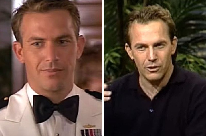 Kevin Costner’s Hair Transplant: Everything You Need to Know