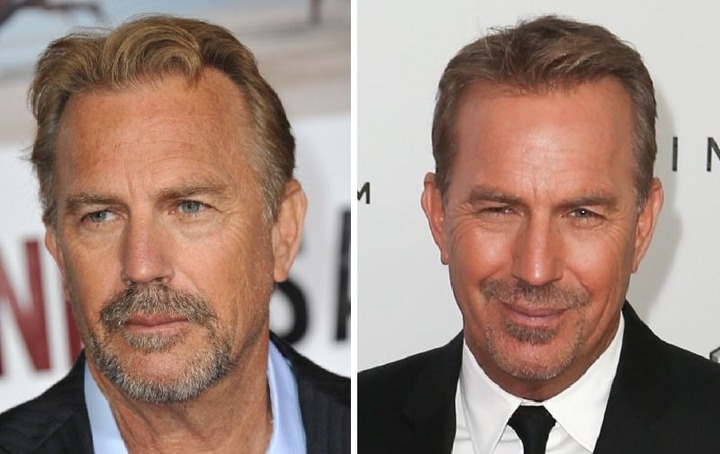 Kevin Costner’s Hair Transplant: Everything You Need to Know