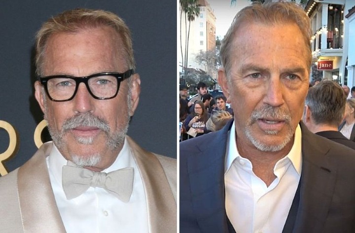 Kevin Costner’s Hair Transplant: Everything You Need to Know