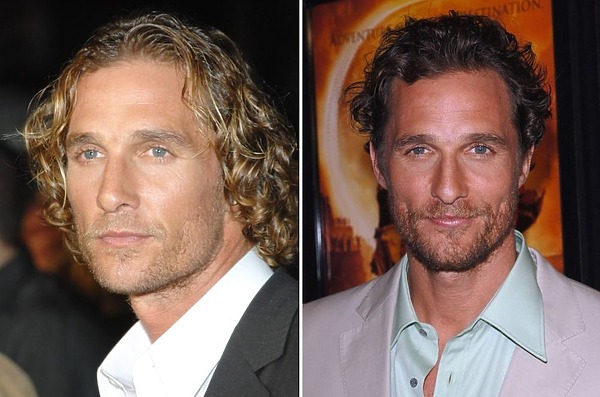 Matthew McConaughey’s Hair Transplant: Why The Rumour Started