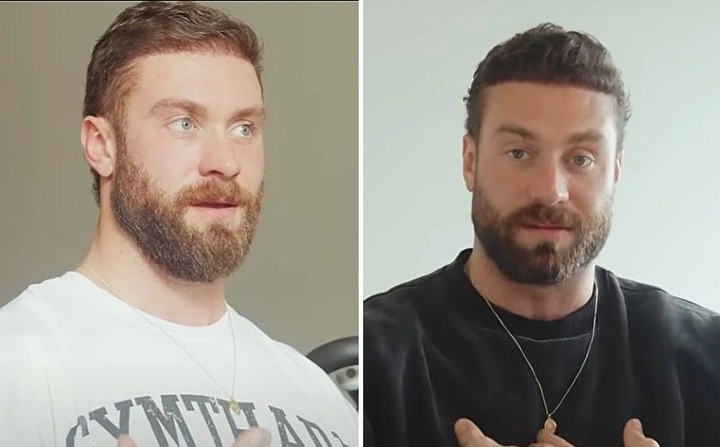 Chris Bumstead’s Hair Transplant - The Full Scoop